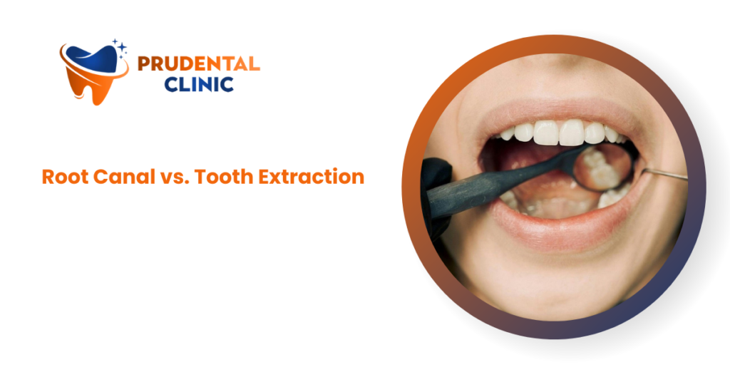 Root Canal vs. Tooth Extraction | Prudental Clinic